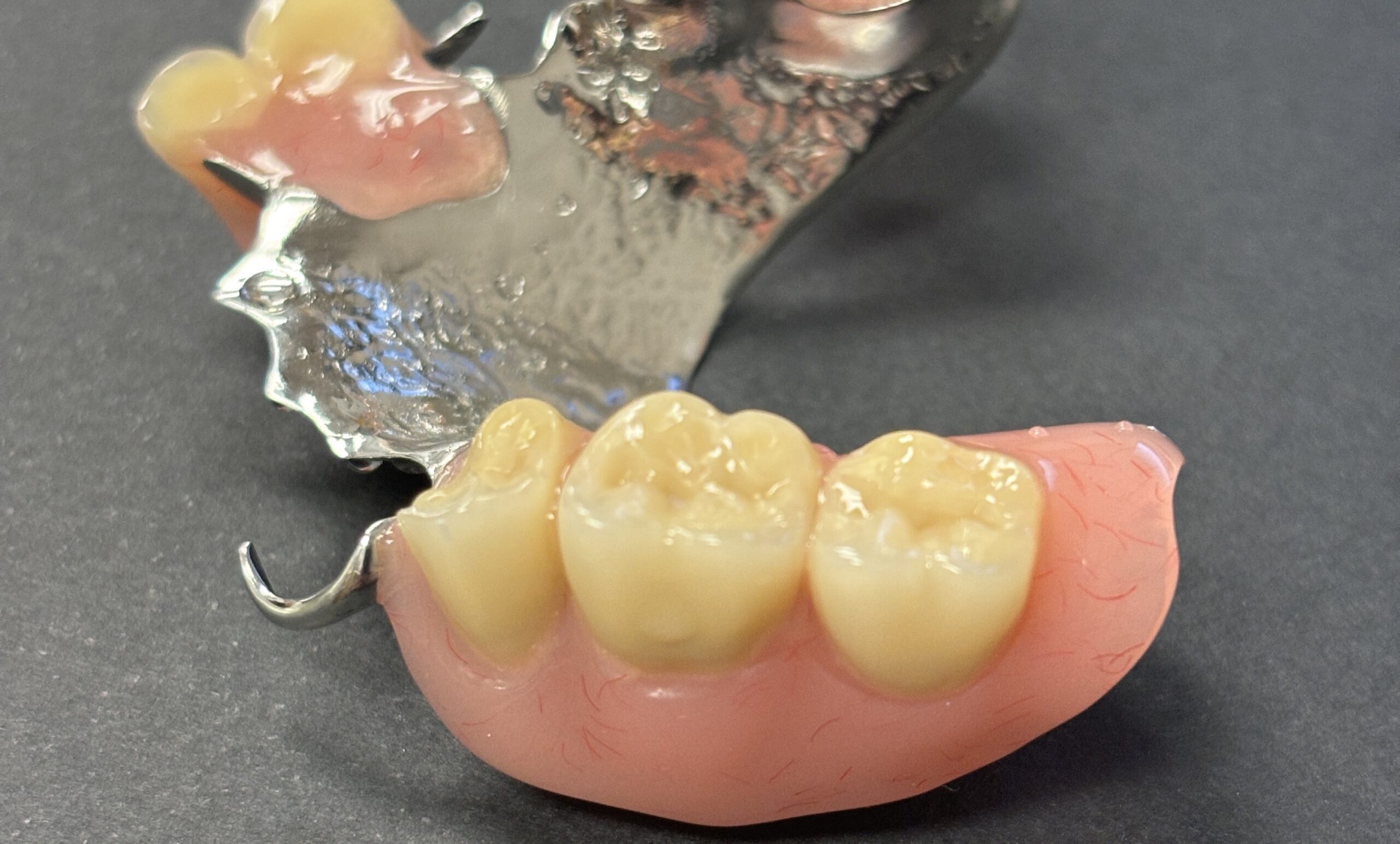 Our Removable | The Art of Aesthetics